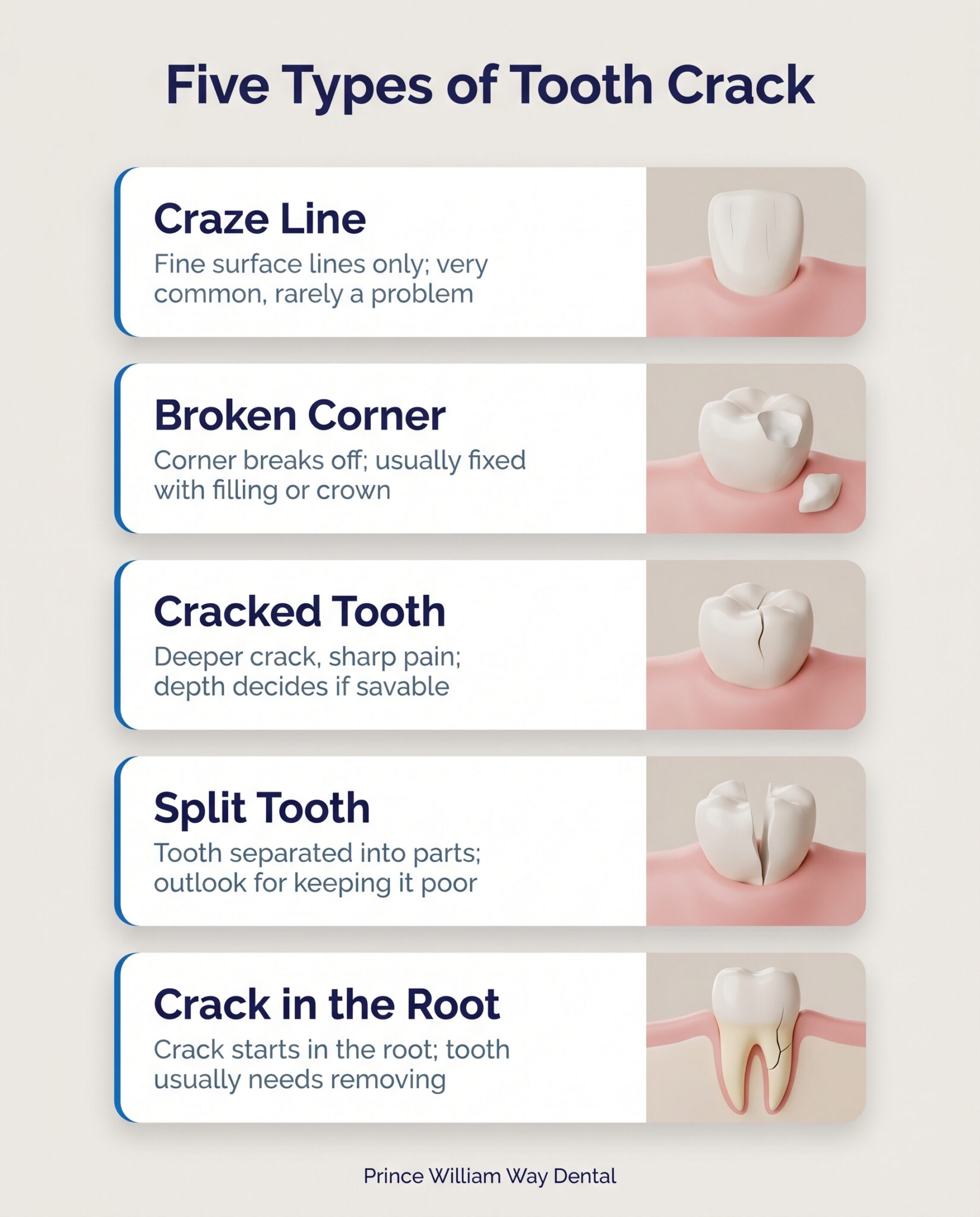 Teeth Grinding and Cracked Teeth: Spot It, Stop the Damage | Prince ...
