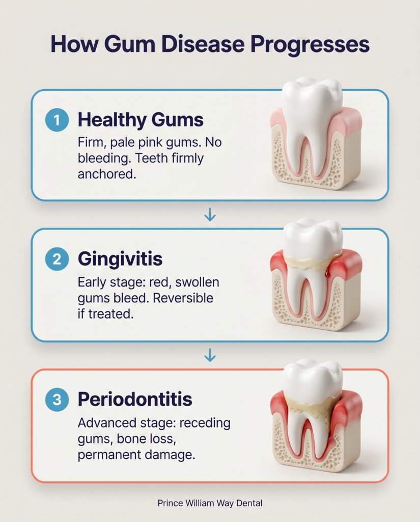 Gum Disease: Signs, Causes and Treatment | Prince William Way Dental